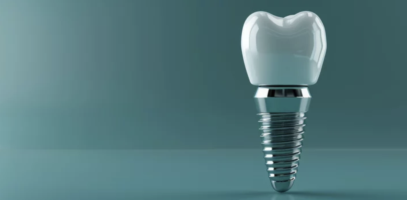 Dental Implants | Kansas City - Love To Smile