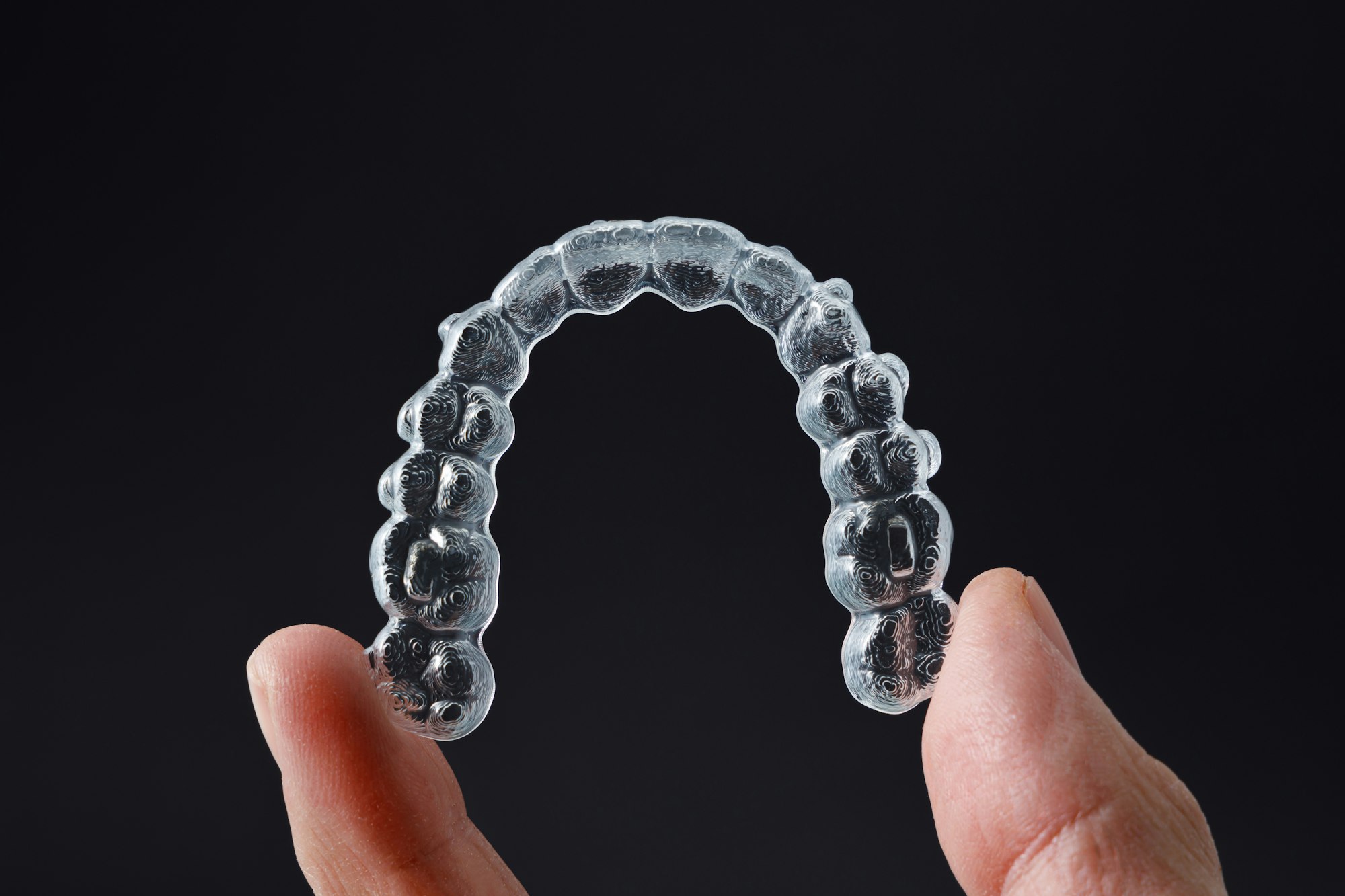 Invisalign in Johnson County for Teens: Affordable Confidence That ...